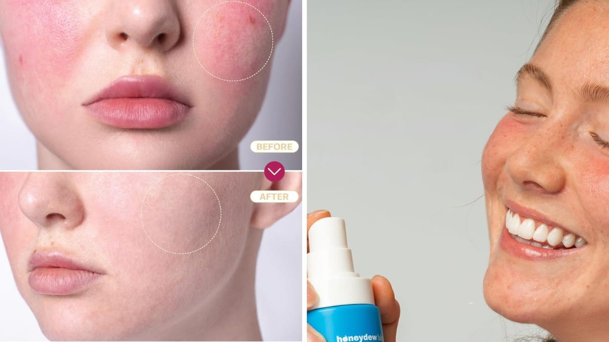 Hypochlorous Acid Spray: Learn About The Surprising Benefits of ...